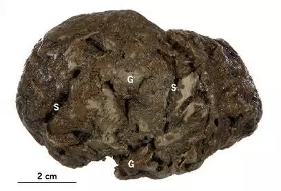 Ang 800-Year nga Fossilized Brain Nakit-an nga Naglangkob sa Intact Remnants sa Brain Cells 21339_1