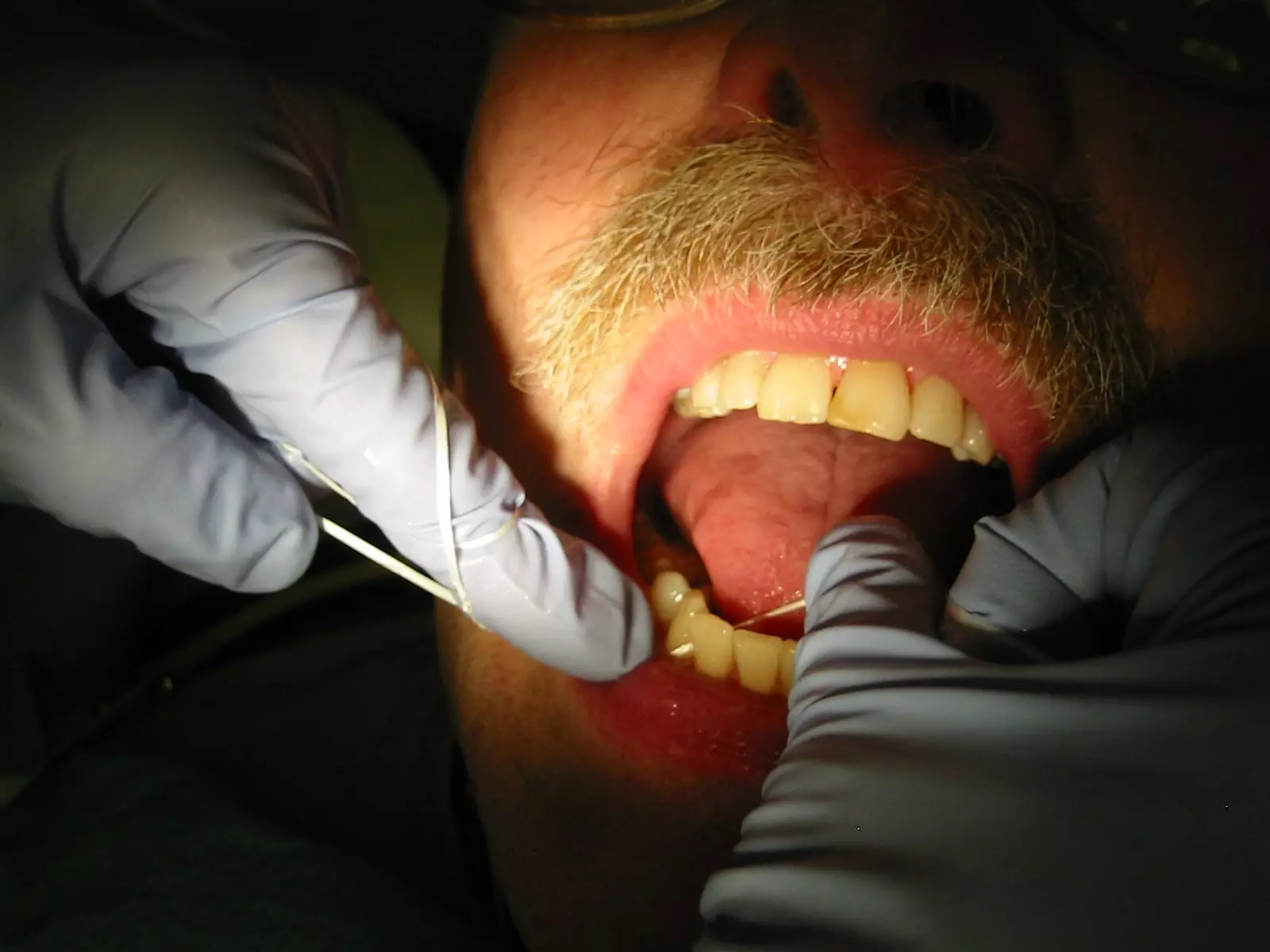 Hat jemand überprüft, ob Zahnseide tatsächlich funktioniert?